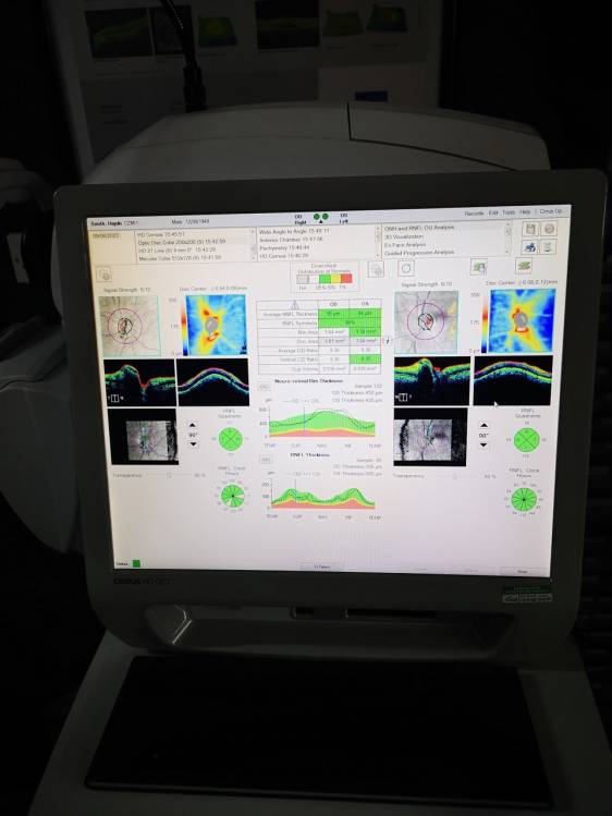 Zeiss Cirrus 500 OCT with Ant Seg | Used OCT | Ophthalmic Equipment ...