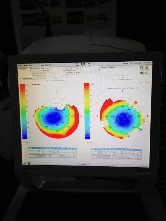 Zeiss Cirrus 500 OCT with Ant Seg | Used OCT | Ophthalmic Equipment ...