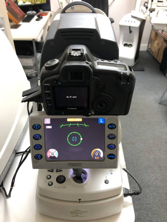 Nidek AFC 210 Fundus Camera | Used Fundus Camera | Ophthalmic Equipment ...